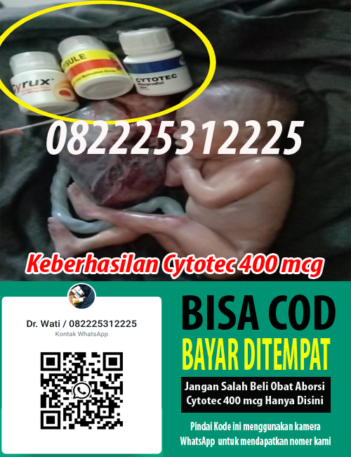 Misoprostol Cytotec 400mcg by Afzaall Deel